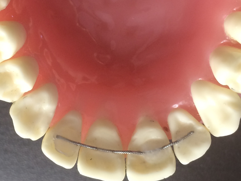 Treatment Options | Milton Orthodontics